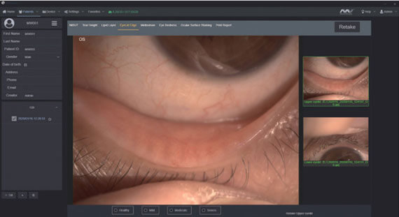 Firefly Slit Lamp Imaging System | David Keith Ophthalmic